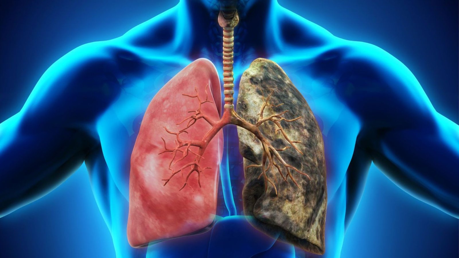 Health Impacts Of Smoking On Lung Function